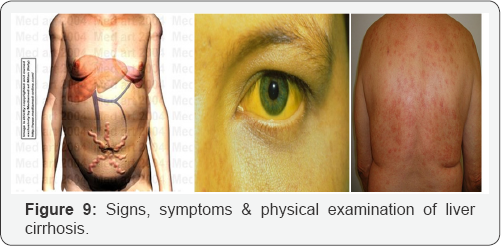 Gastroenterology Open Access Journals Gastroenterology Journals Gastroenterology Open Access Journals Gastroenterology Journals