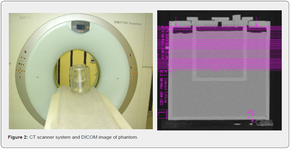 Implementation of MRI Normoxic Polymer Gel Dosimetry in External Beam ...