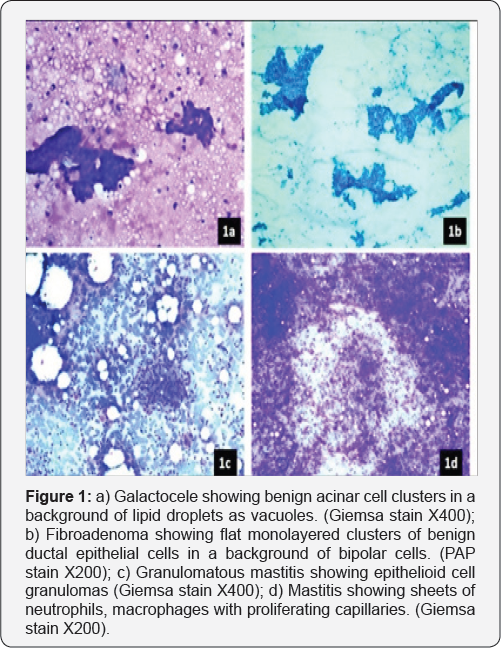 Journal of Reproductive Medicine | Juniper Publishers