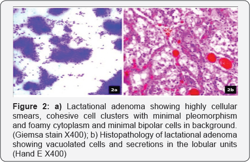 Journal of Reproductive Medicine | Juniper Publishers